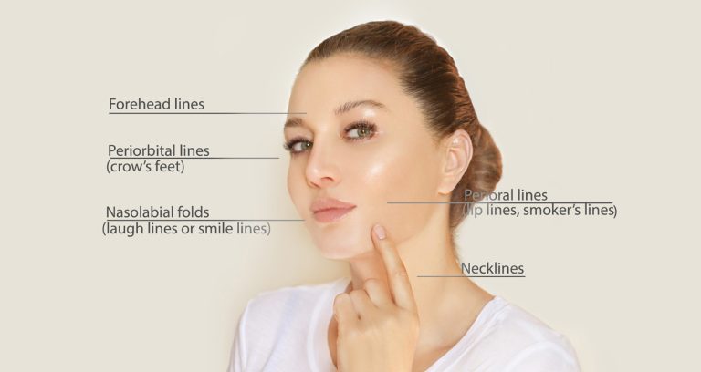 Rhinoplasty – Nose fillers – Miss Hudson